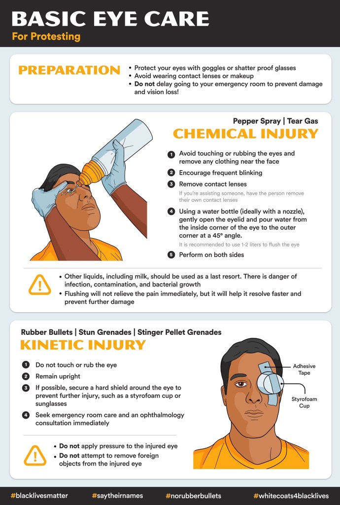 Tear gases and rubber bullets can cause permanent eye damage, eye ...